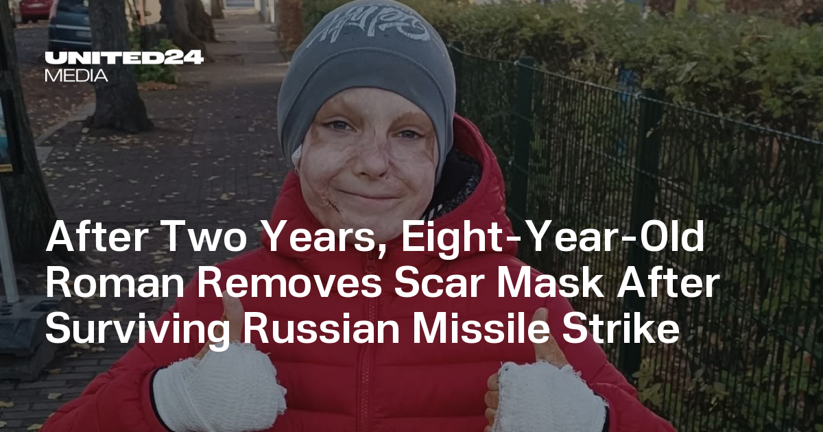 After Two Years, Eight-Year-Old Roman Removes Scar Mask After Surviving ...