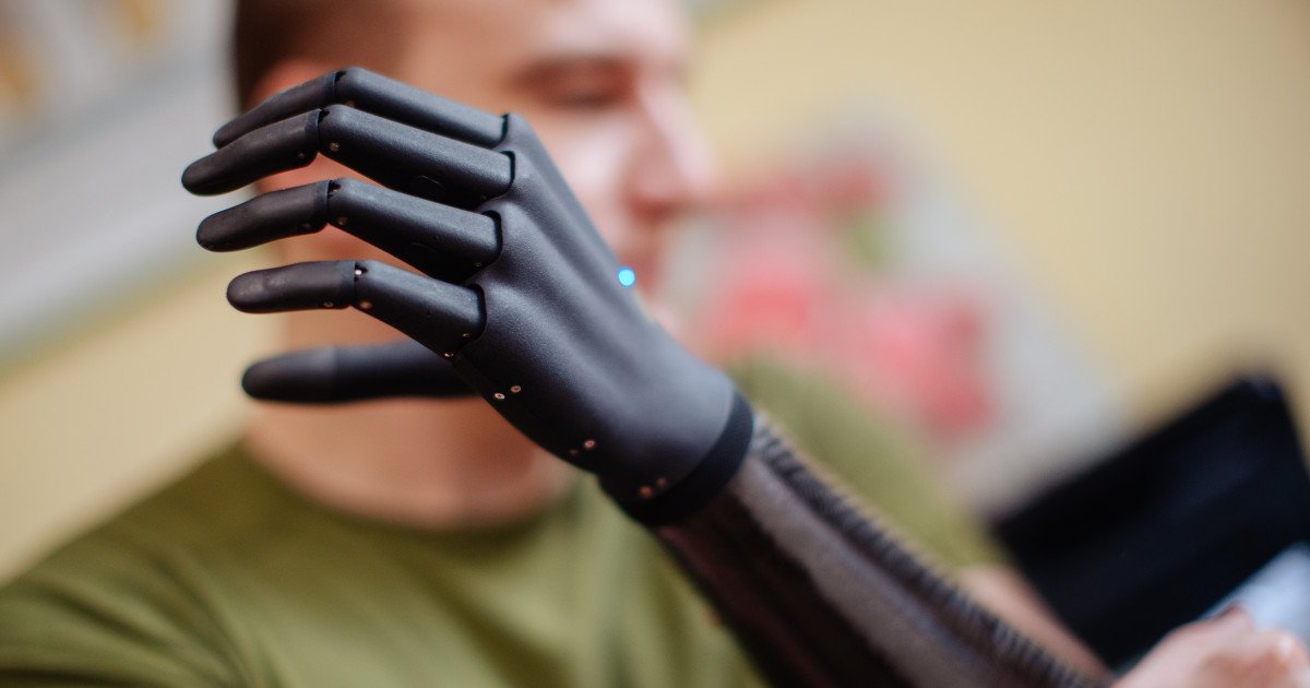 Ukrainian Prosthetic Producer Esper Bionics Raises $5 Million in ...